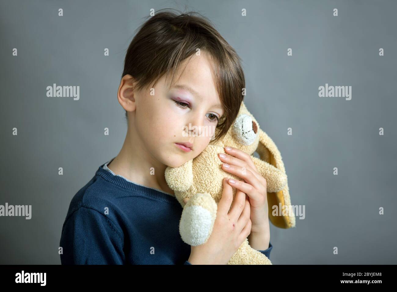 Bruised child hi-res stock photography and images - Alamy