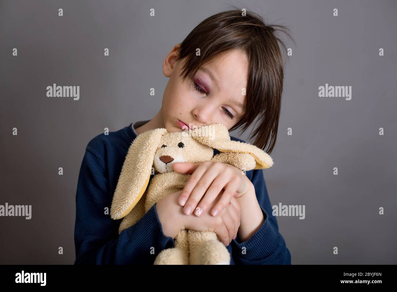Sad little school boy with black eye, bruisiness, child abuse and ...