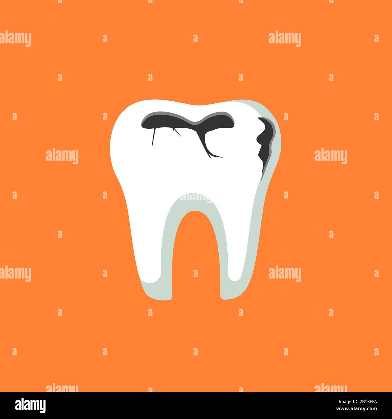 Caries dental problems. Tooth with caries icon. Big hole in the human ...