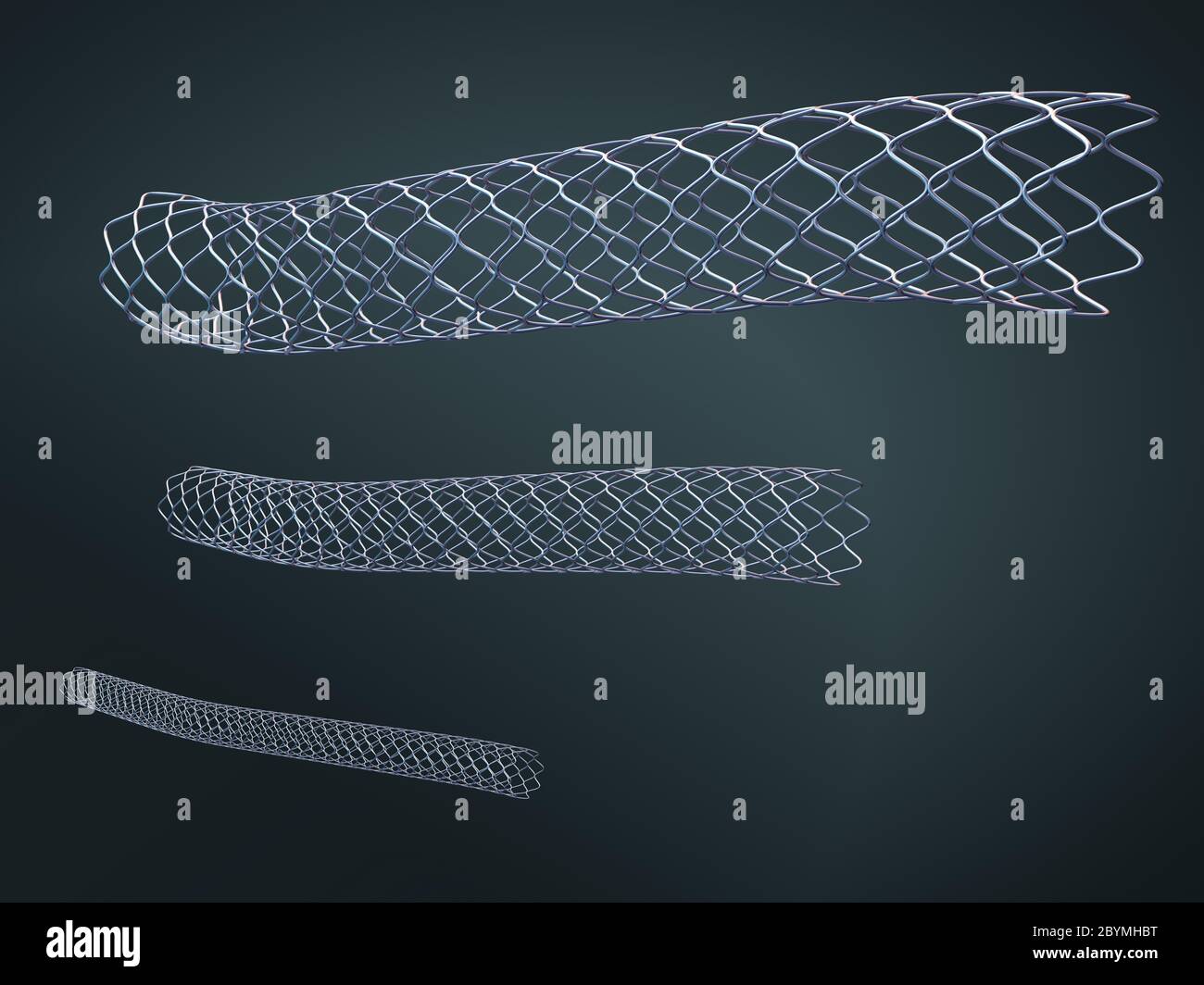 Three metal stents for implantation and supporting blood circulation ...