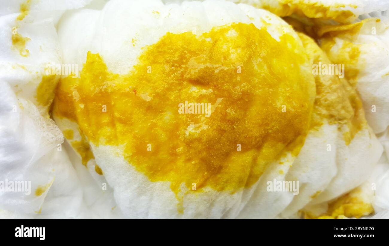 baby poop diarrhea healthy family Stock Photo - Alamy