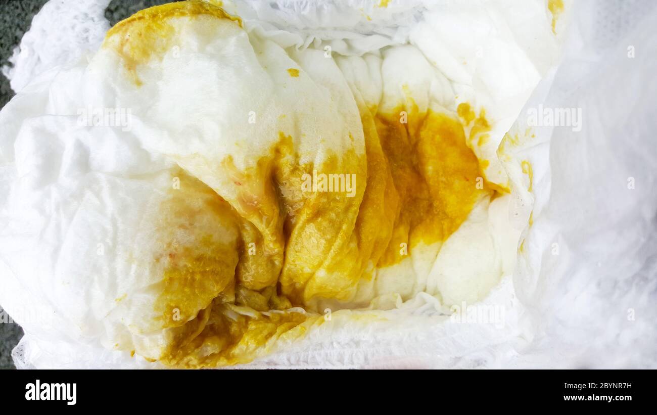 baby poop diarrhea healthy family Stock Photo - Alamy