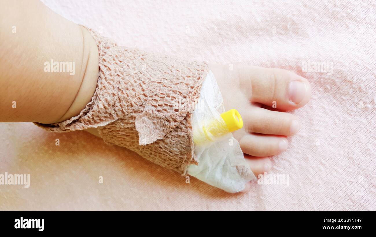 close-up foot of child patient with saline solution drip Stock Photo ...