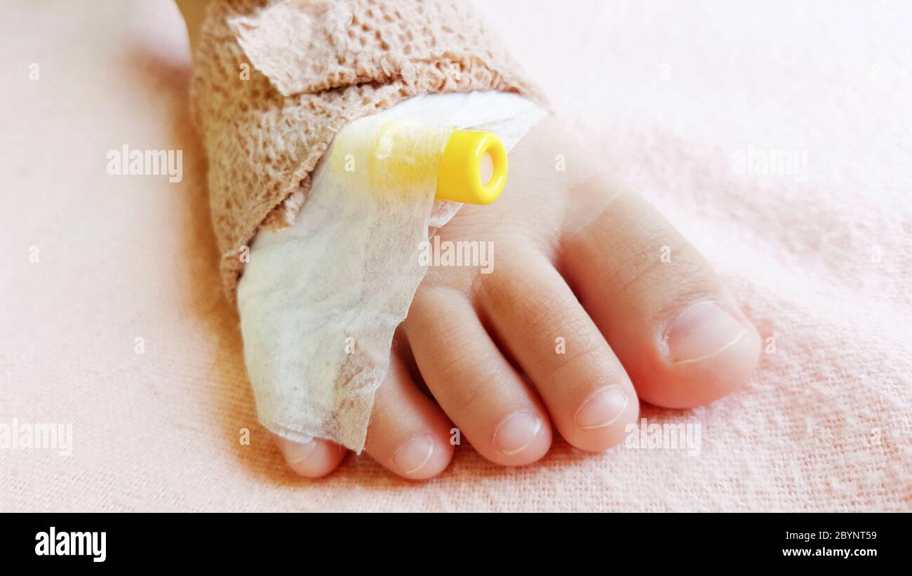 close-up foot of child patient with saline solution drip Stock Photo ...