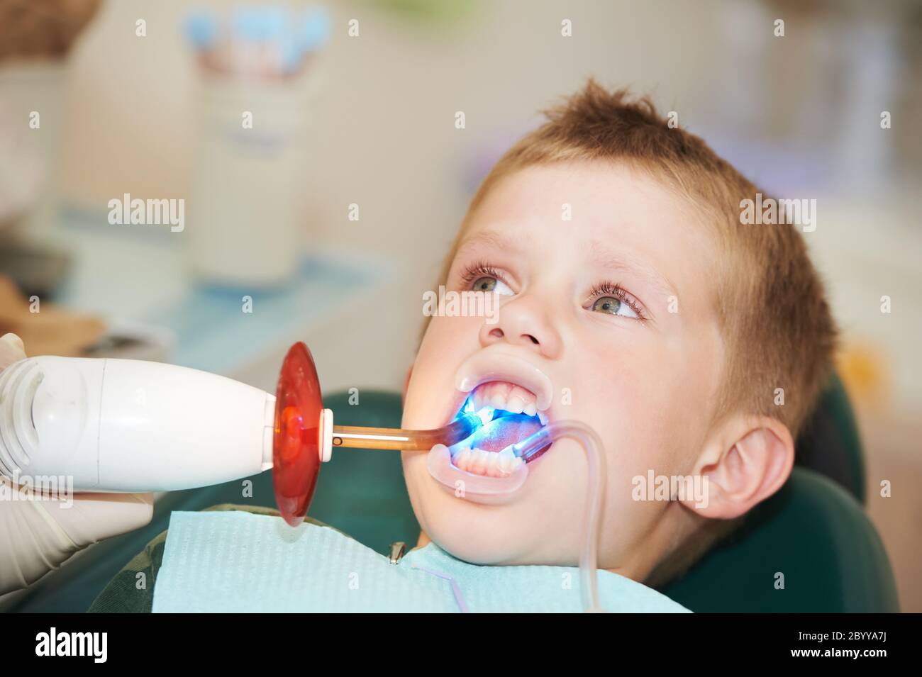dental filing of child tooth by ultraviolet light Stock Photo - Alamy