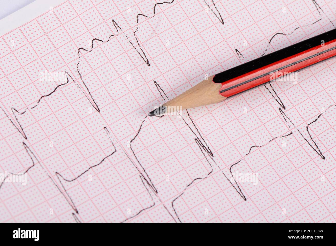The tape with the cardiogram of a man Stock Photo - Alamy