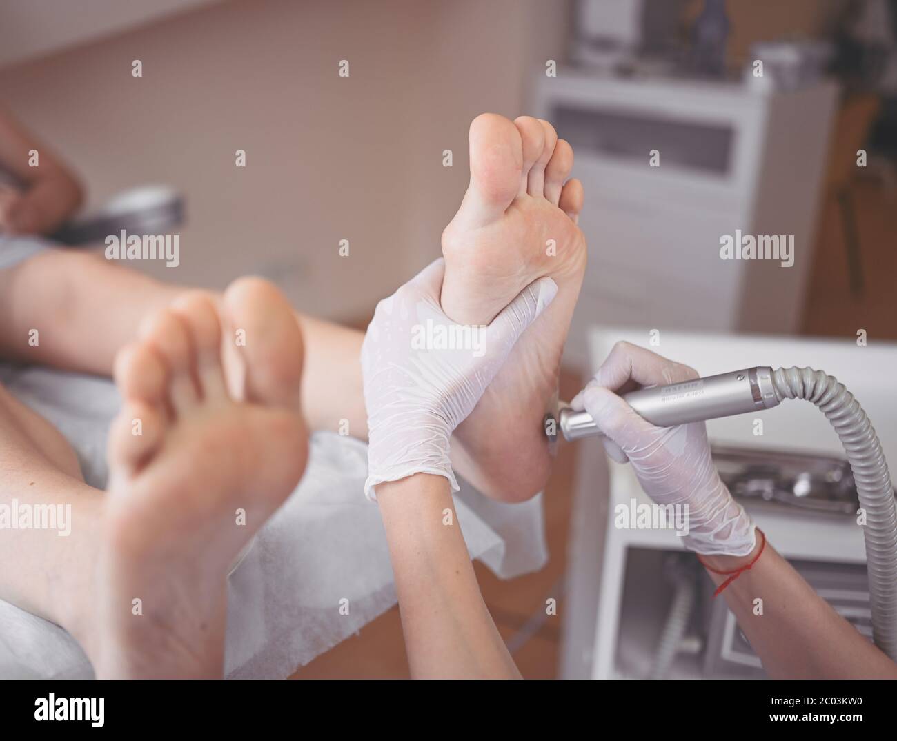 Podiatrist doctor using grinding equipment and making procedure polish ...