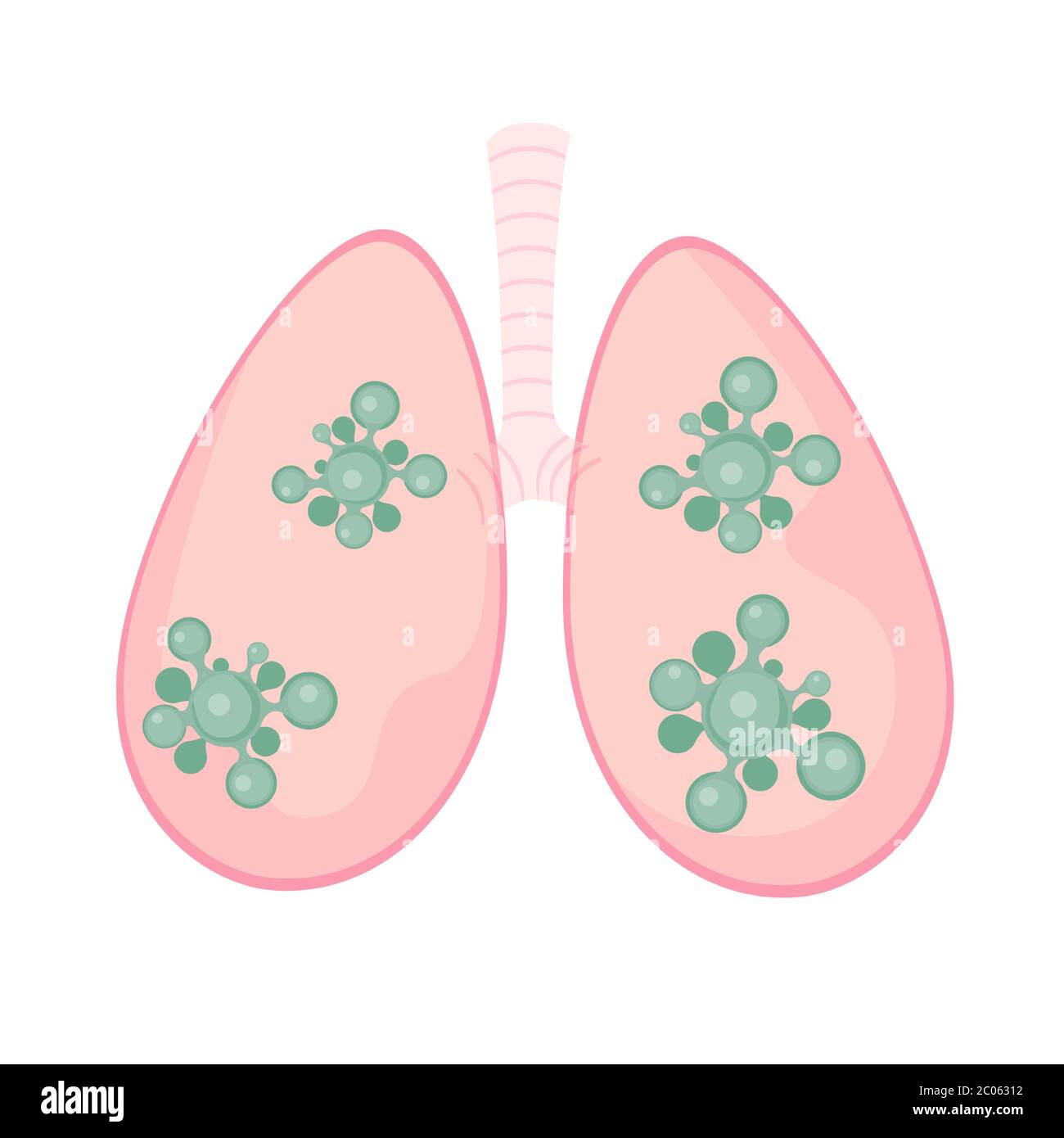 Human lungs infected with Coronavirus cells flat cartoon illustration ...