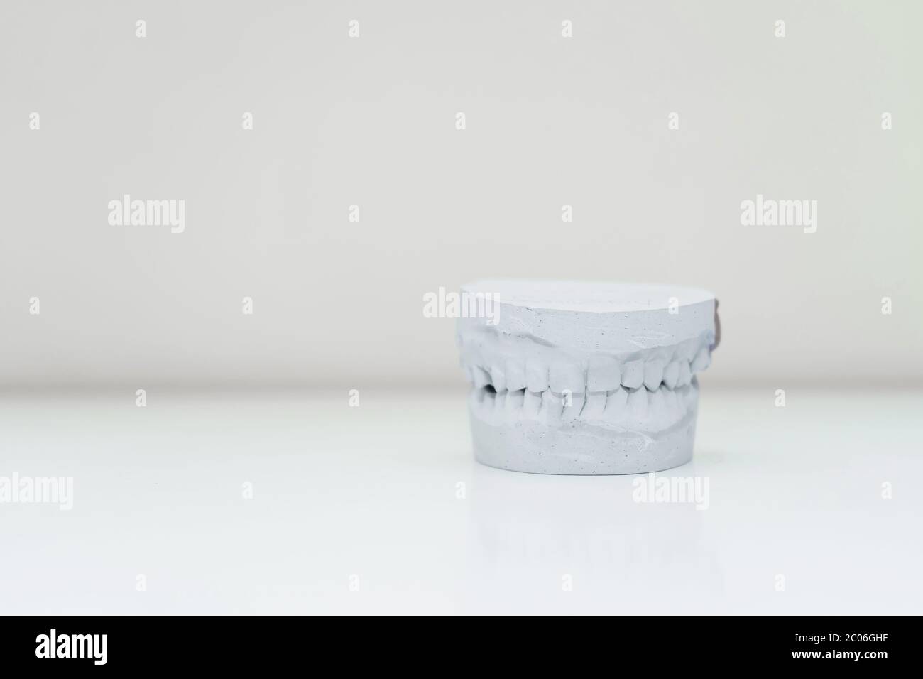 plaster cast of the jaw on a table in a bright room Stock Photo - Alamy