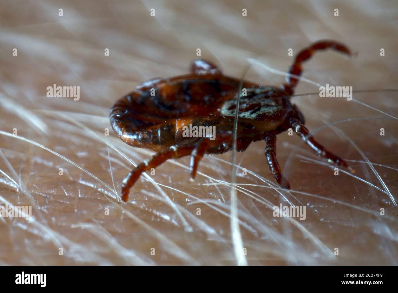 Macro close up of crawling parasitic Dermacentor reticulatus crawling ...