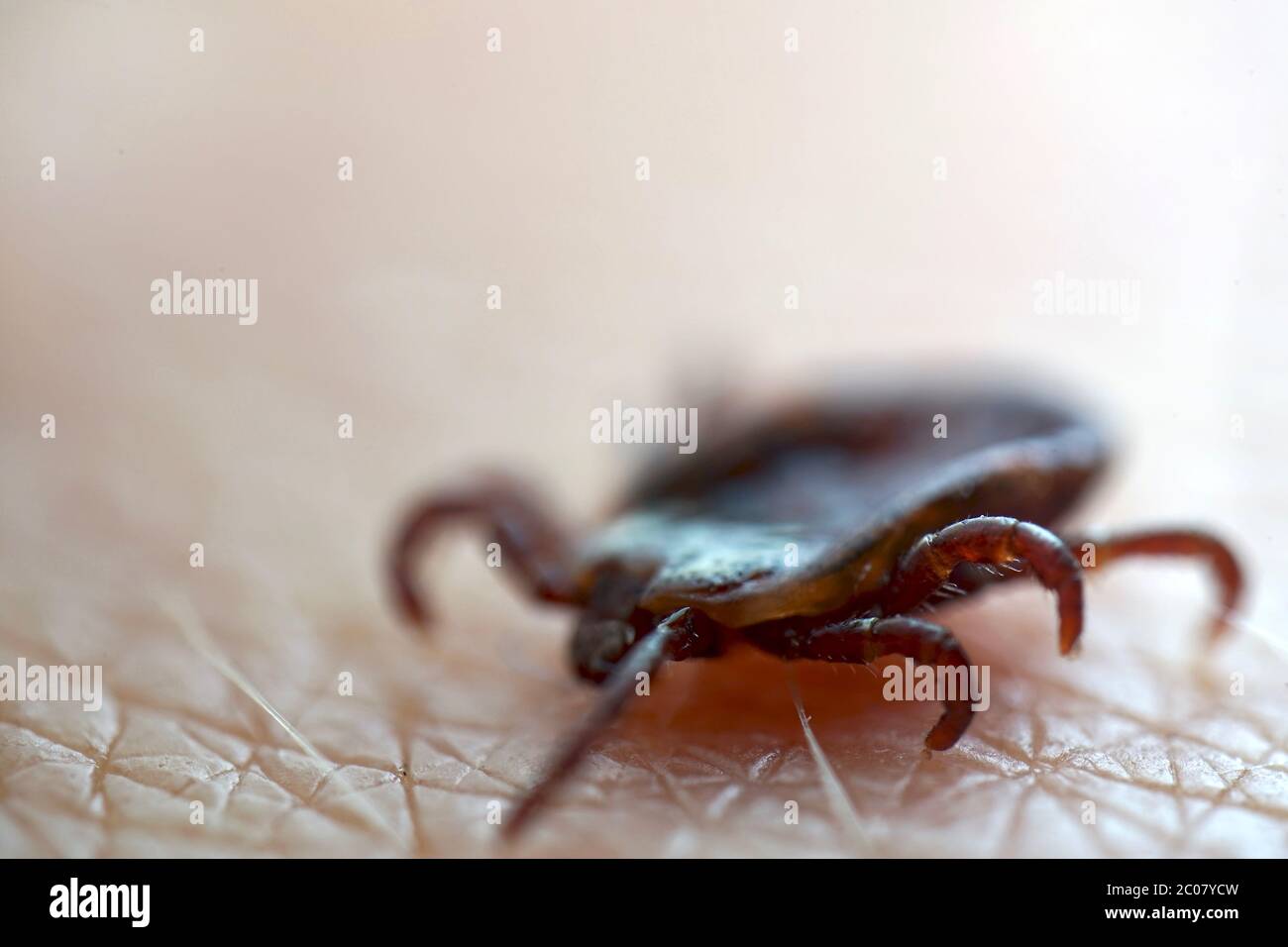Macro close up of crawling parasitic Dermacentor reticulatus crawling ...