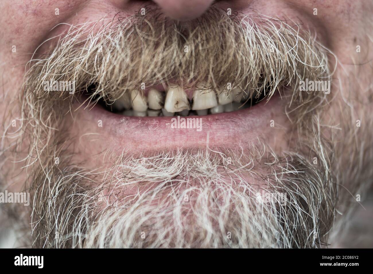Man with tobacco stained teeth Stock Photo - Alamy