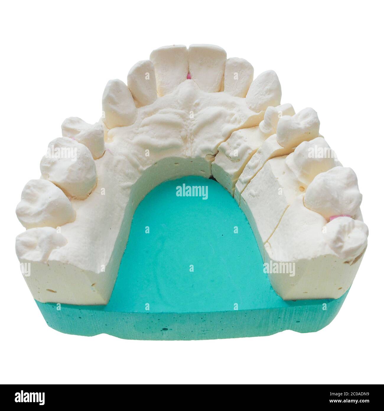 Positive teeth cast Stock Photo - Alamy