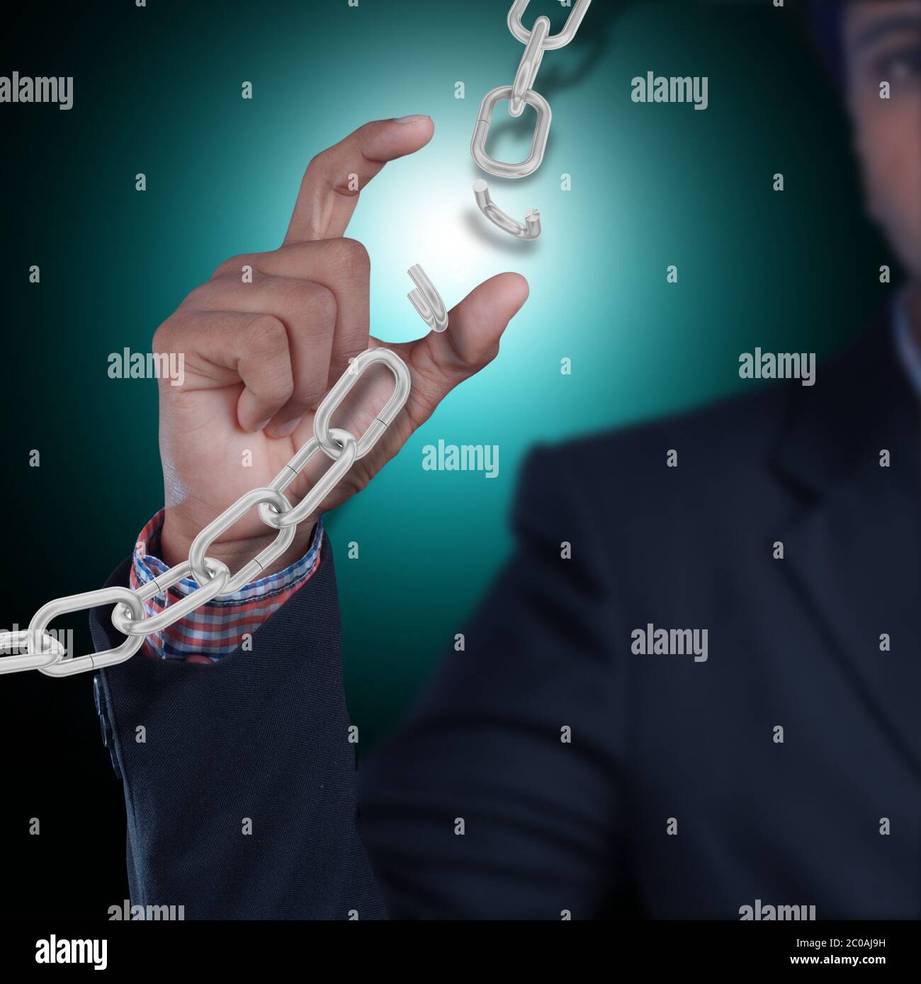 Man broken arm hi-res stock photography and images - Alamy