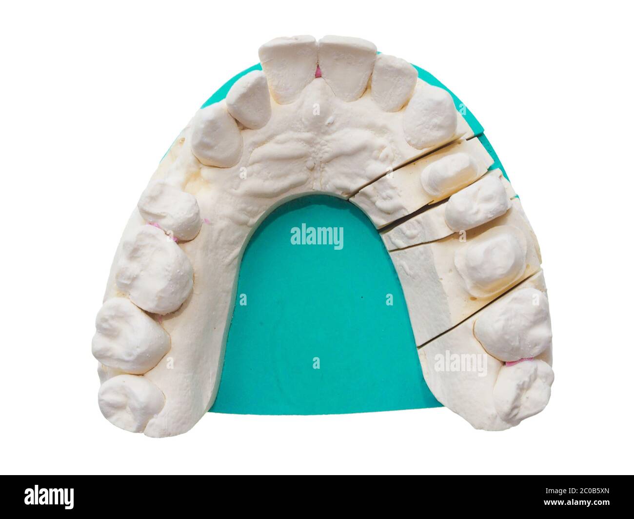 Positive teeth cast Stock Photo - Alamy