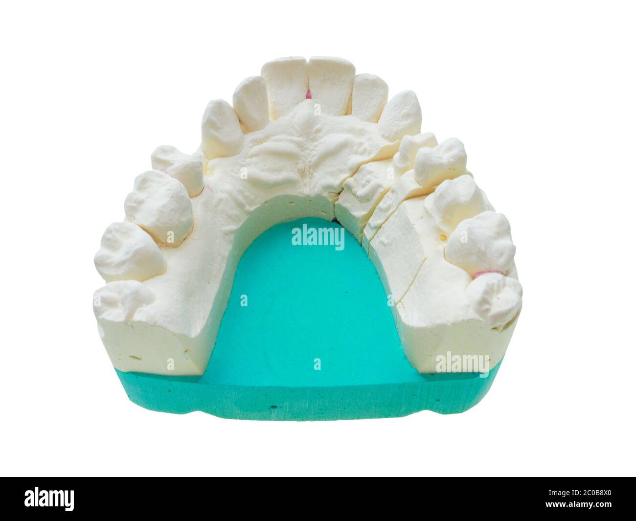 Positive teeth cast Stock Photo - Alamy
