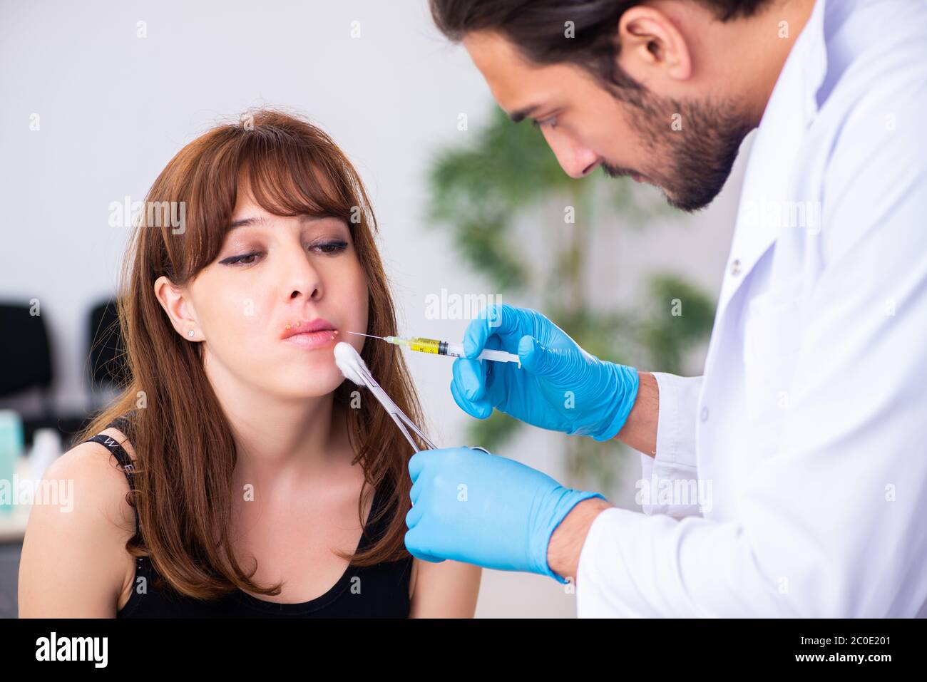 Herpes simplex rash skin hi-res stock photography and images - Alamy