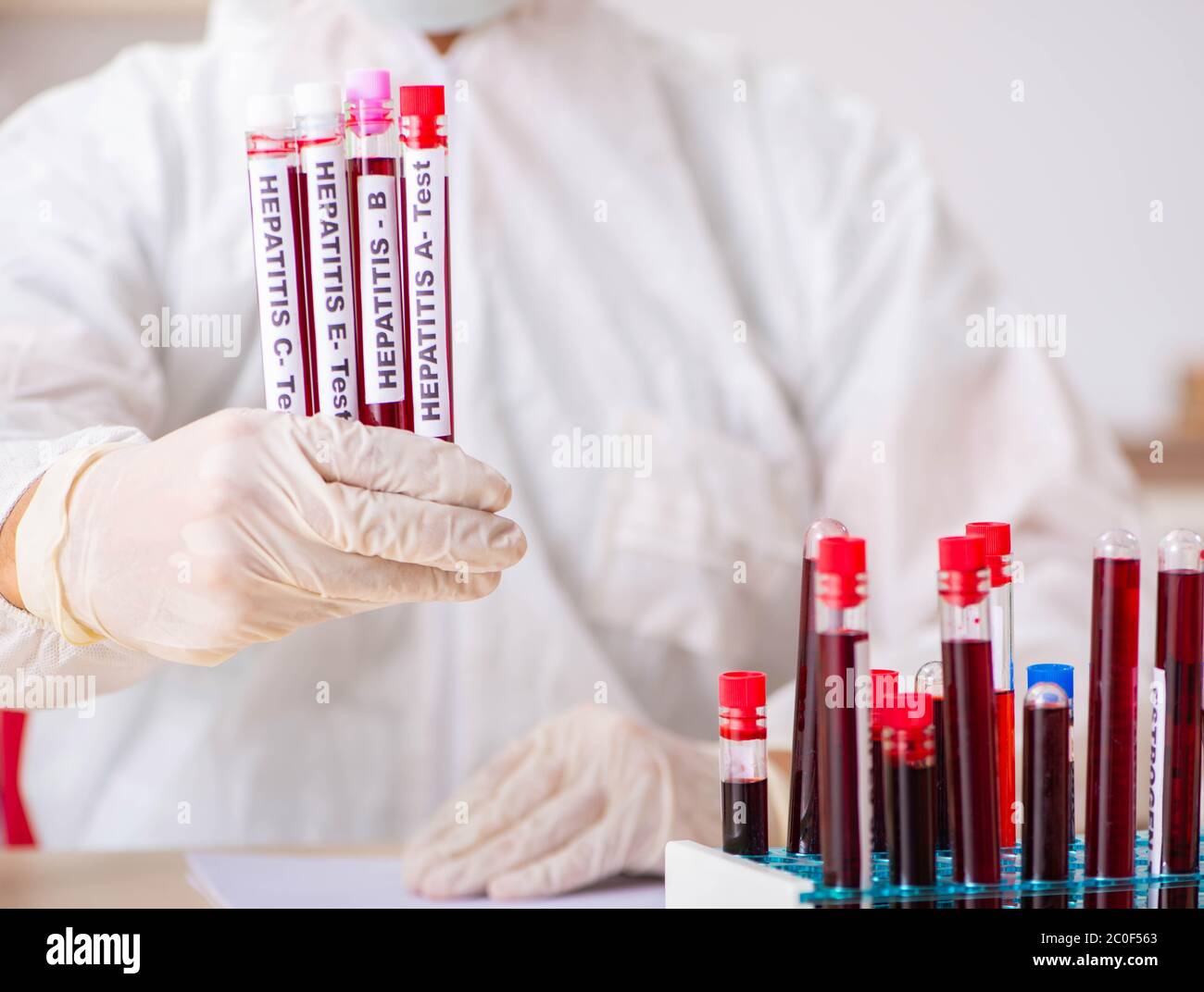 The young handsome lab assistant testing blood samples in hospital ...