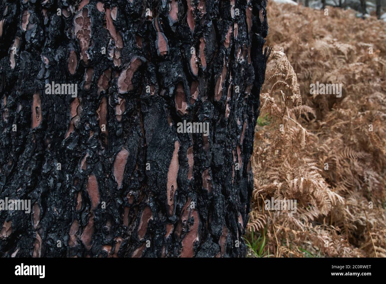 Burned skin hi-res stock photography and images - Alamy