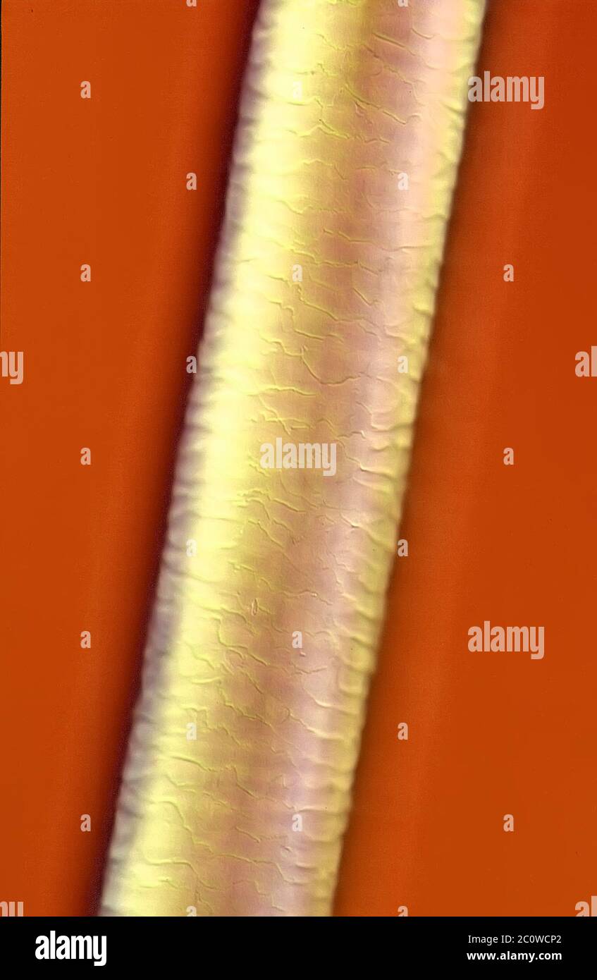 hair from human,microscopic Stock Photo - Alamy