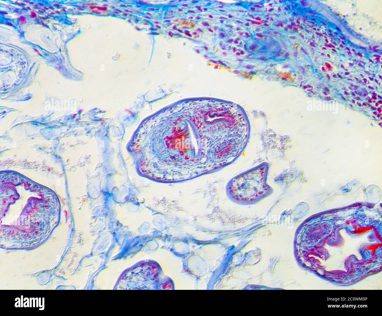 Hydatid hi-res stock photography and images - Alamy