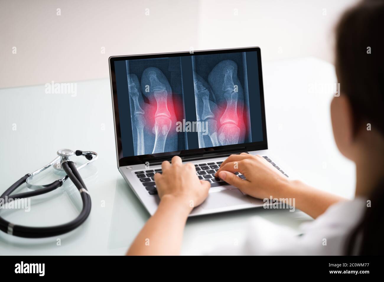 Surgeon Doctor Using Computer Technology For Bone X-Ray Scan Stock ...