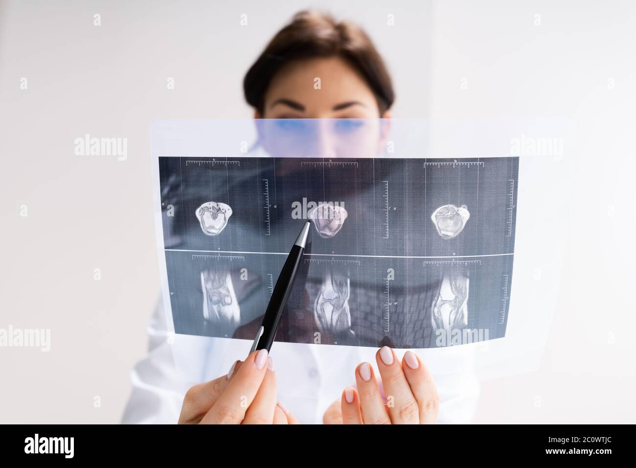 Bone expert hi-res stock photography and images - Alamy