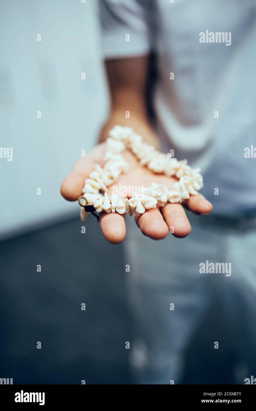 Removed healthy human teeth according to orthodontic indications on the ...