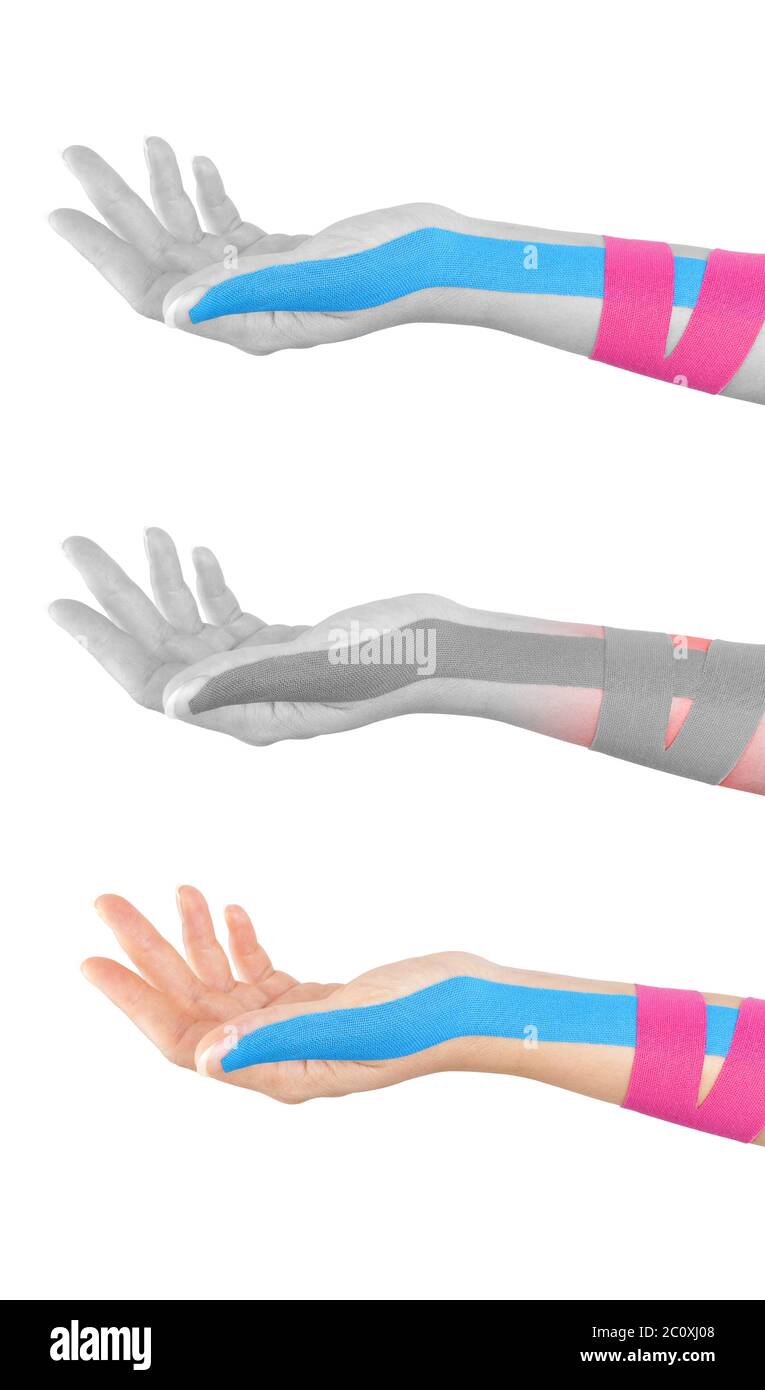 Kinesio hand hi-res stock photography and images - Alamy