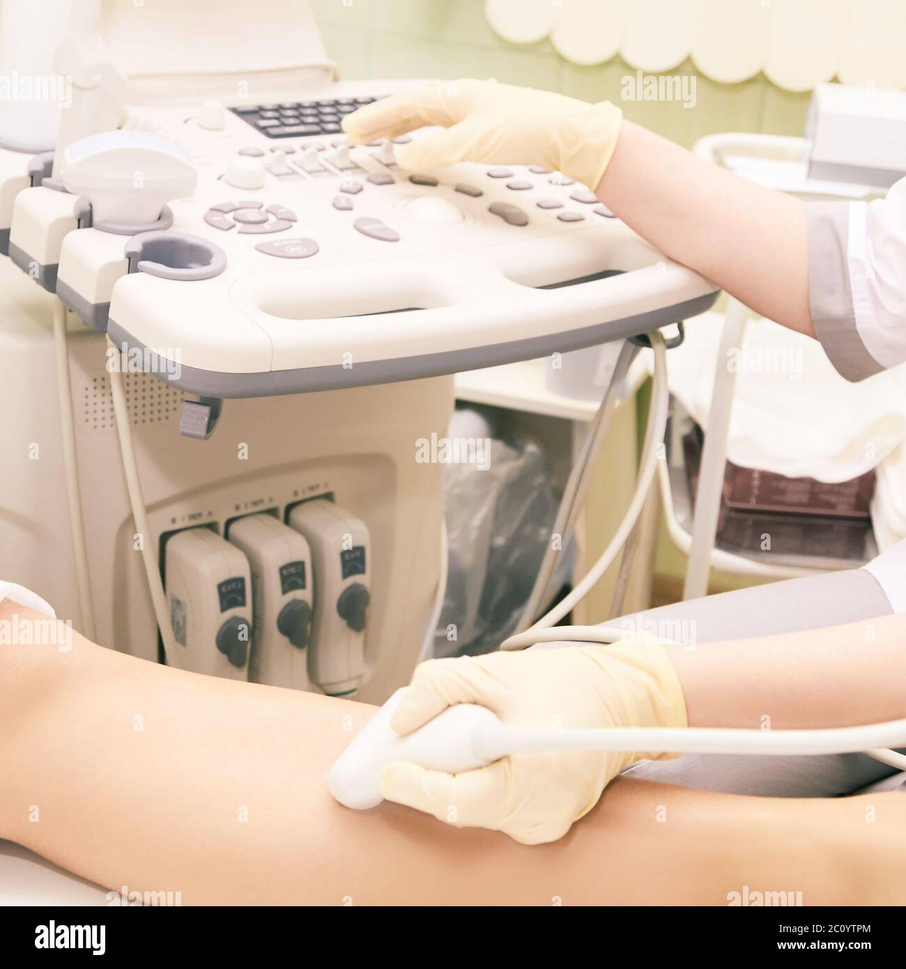 Medical examination. Ultrasonography. Patients leg. Cosmetology ...