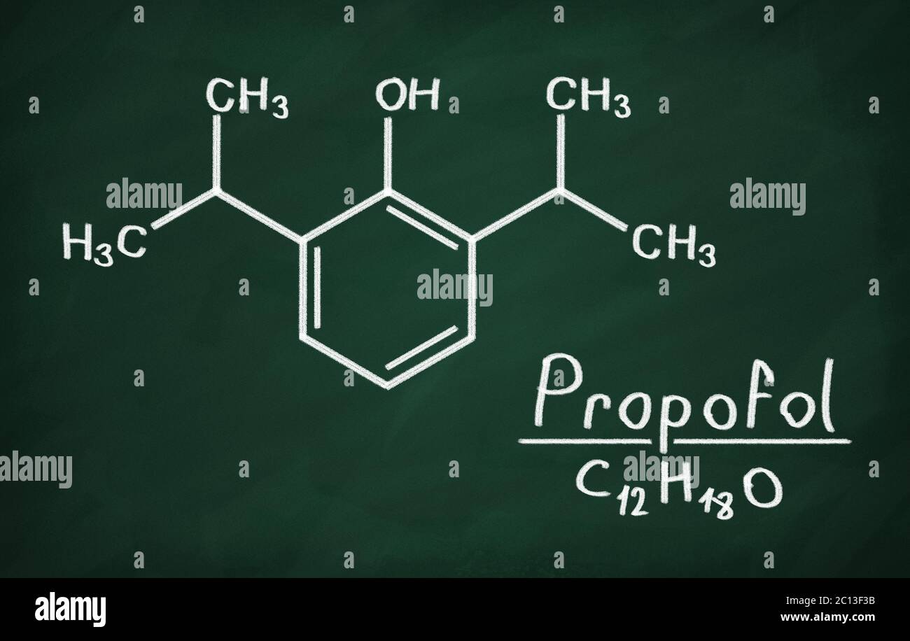 Propofol hi-res stock photography and images - Alamy