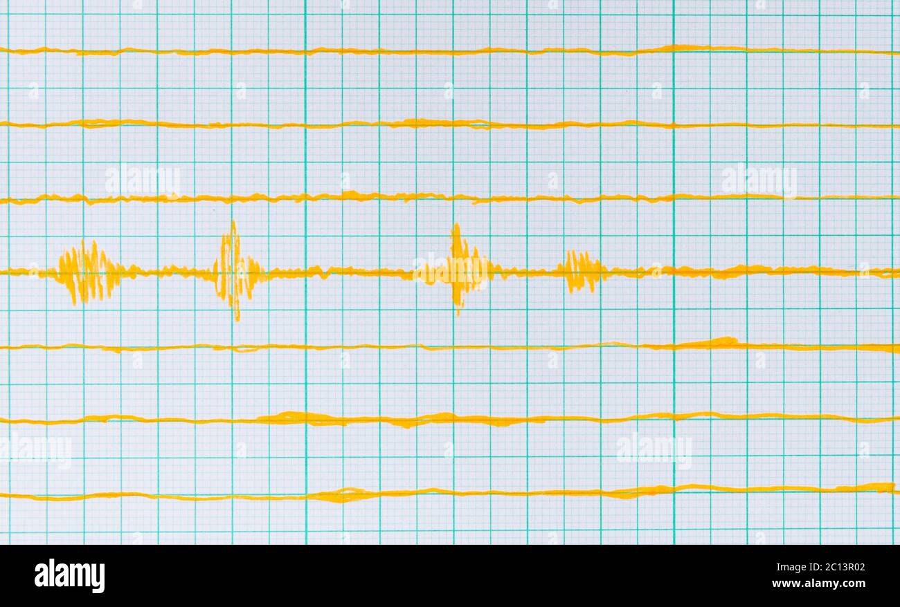 Seismological device sheet - Seismometer Stock Photo - Alamy