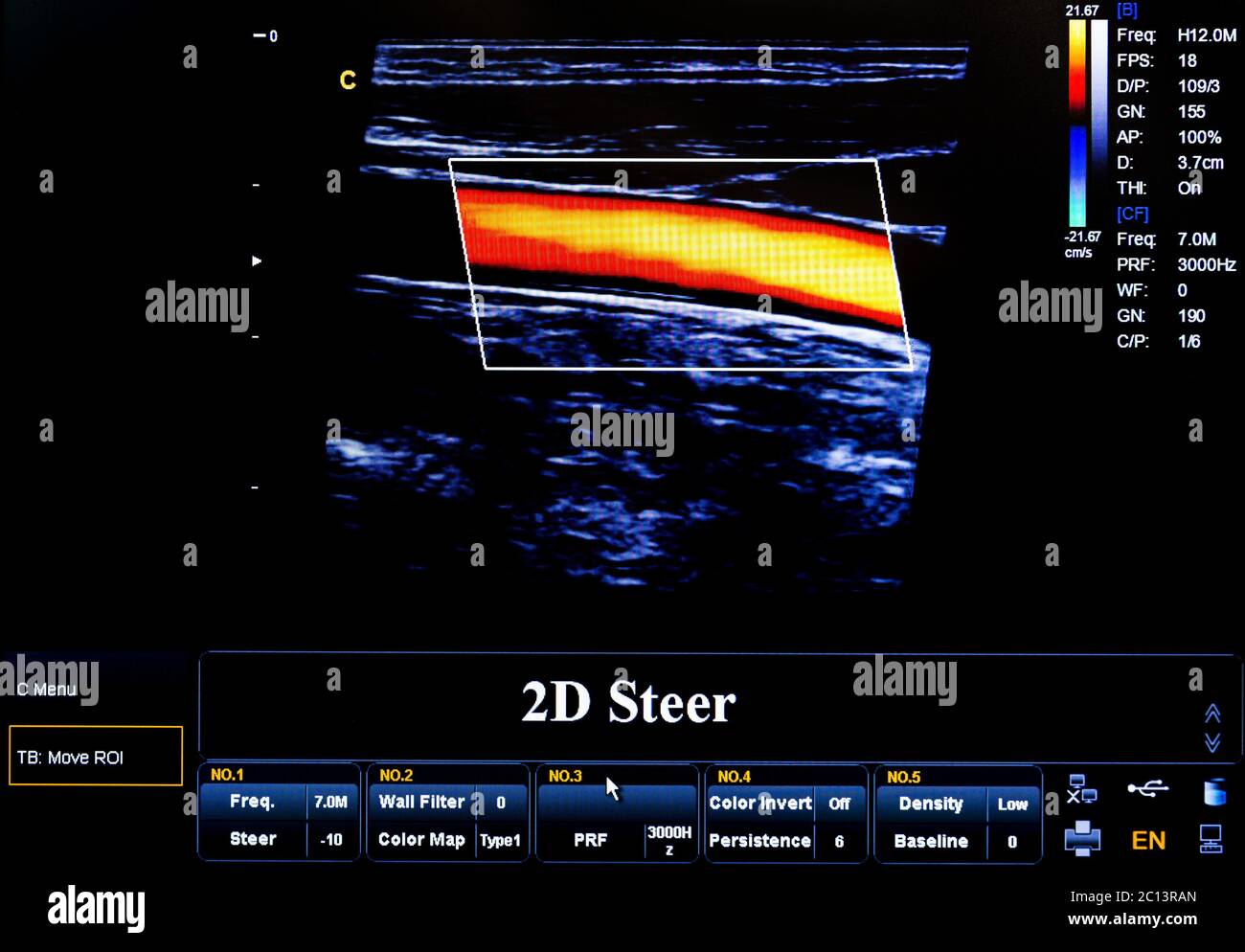 Colourful ultrasound monitor image. 2D Steer Stock Photo - Alamy