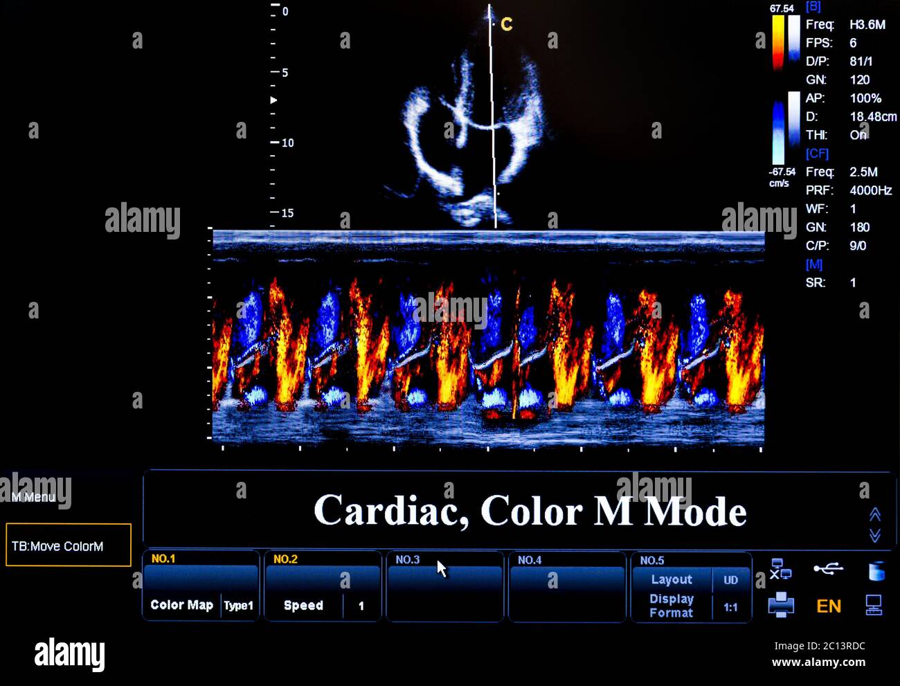 Colourful ultrasound monitor image. Cardiac Stock Photo - Alamy
