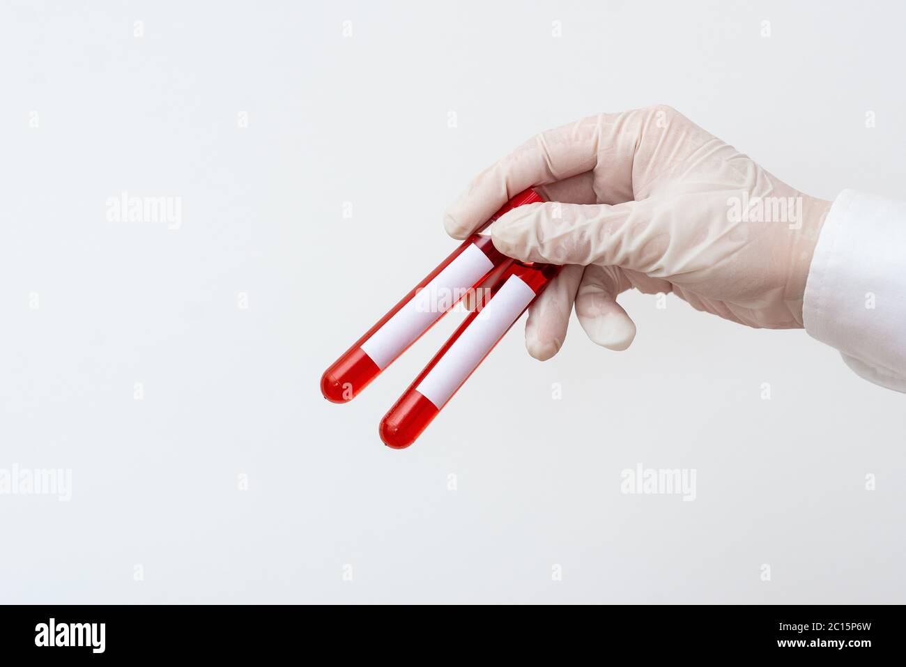 Extracted Blood Sample Vial Ready For Medical Diagnostic Examination ...
