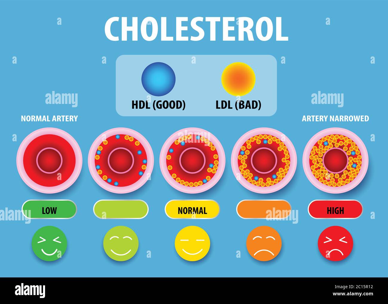 Cholesterol in artery, health risk , vector design Stock Vector Image ...