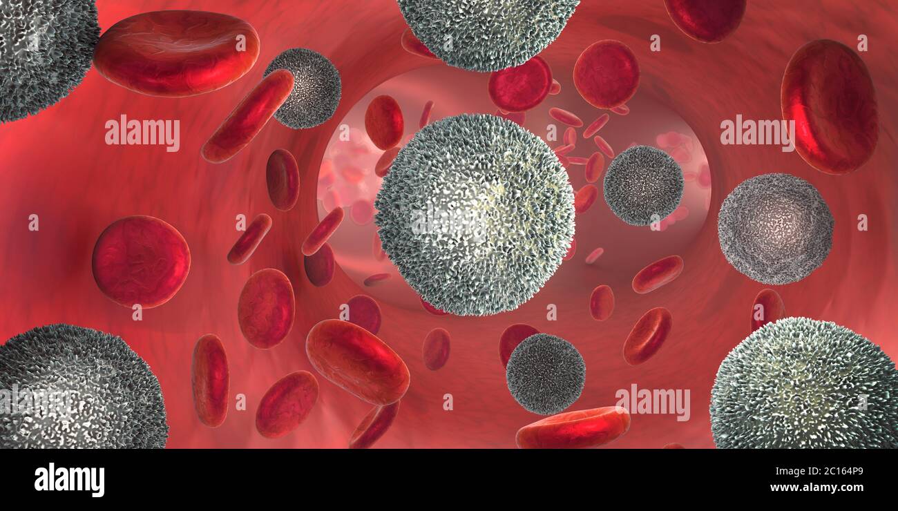 Enlarged Blood Cells Cancer