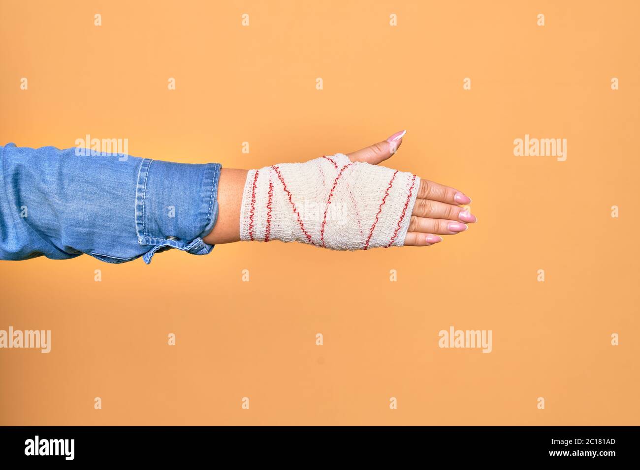 Wounded hand of caucasian young woman cover with bandage doing ...