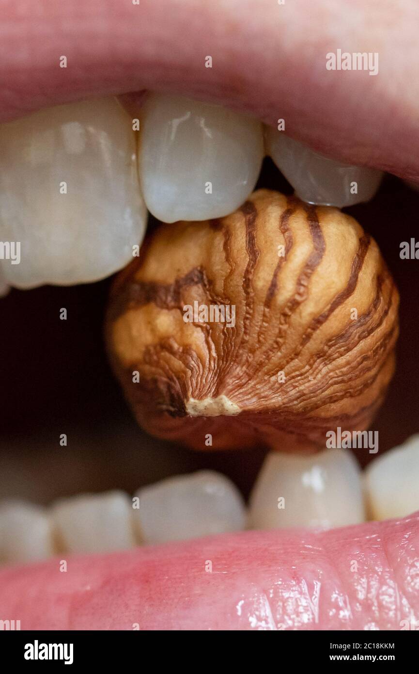 Teeth allergies hi-res stock photography and images - Alamy