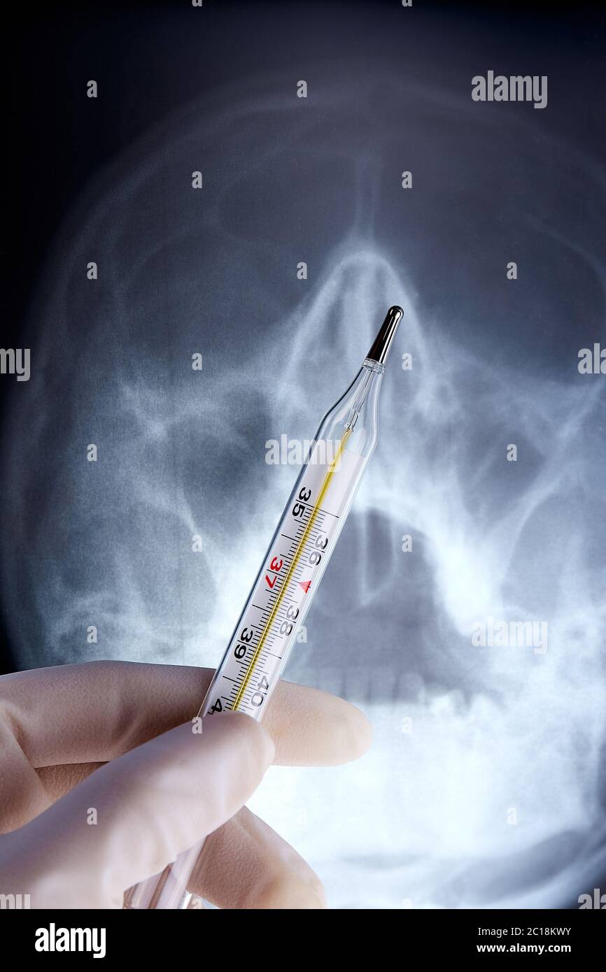 Mercurial thermometer and x-ray of head in hand with medical sterile ...