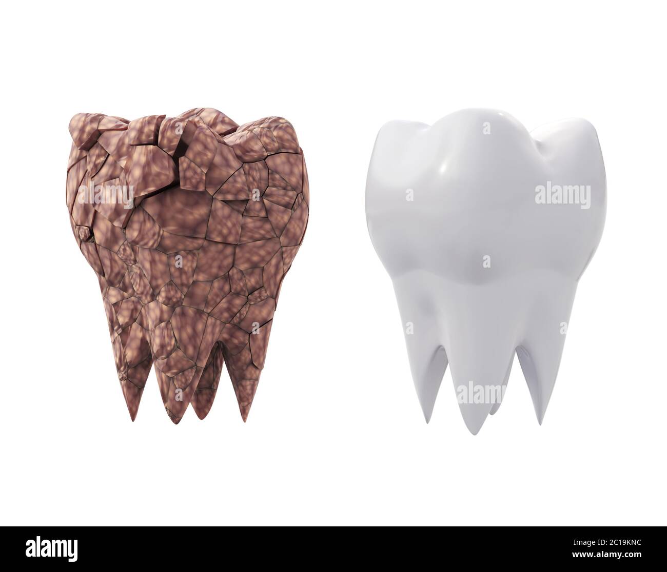 dirty plaque broken molar tooth and clean white tooth isolated on white ...