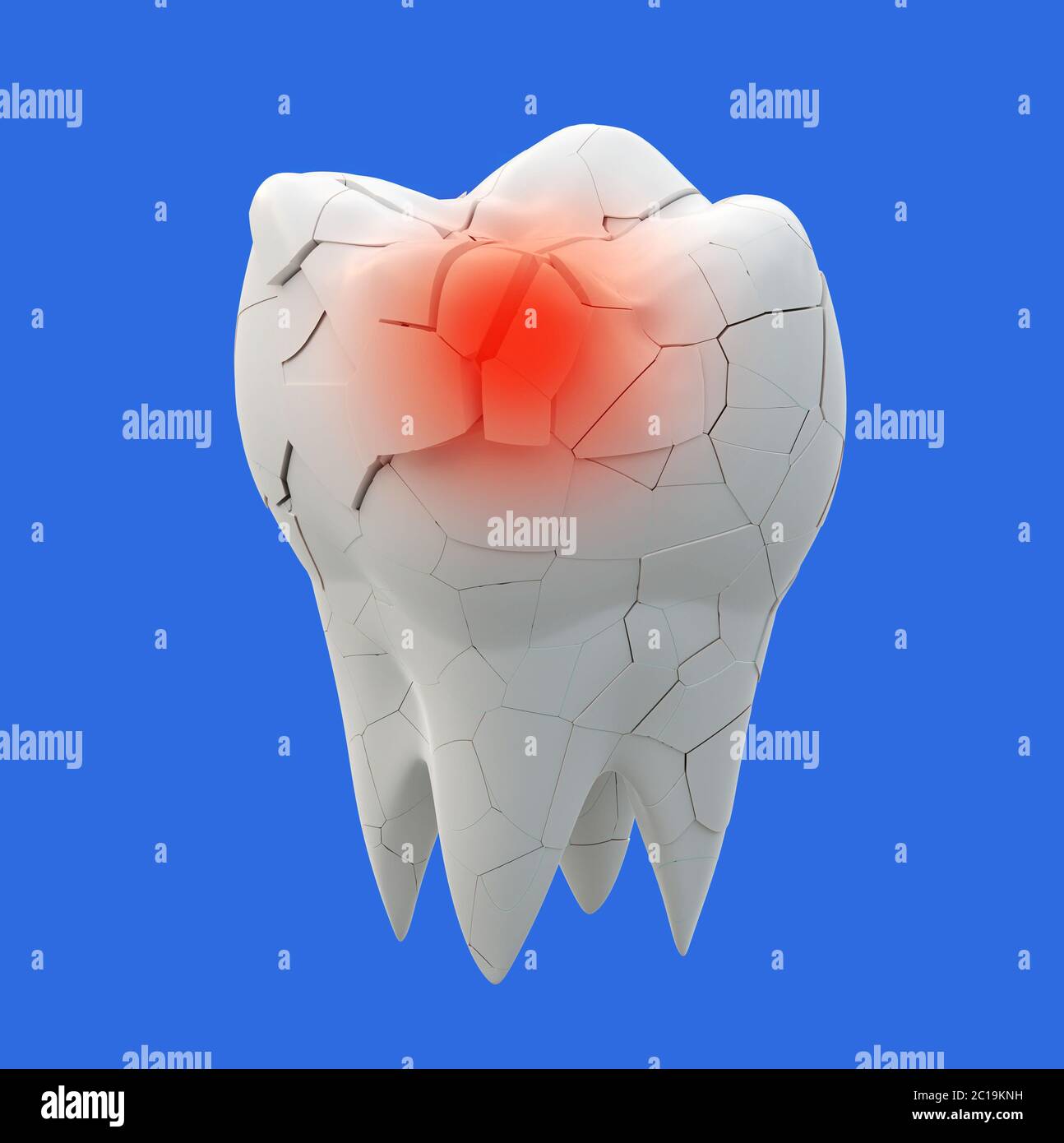 Broken molars tooth and whole tooth isolated on blue background. 3d ...