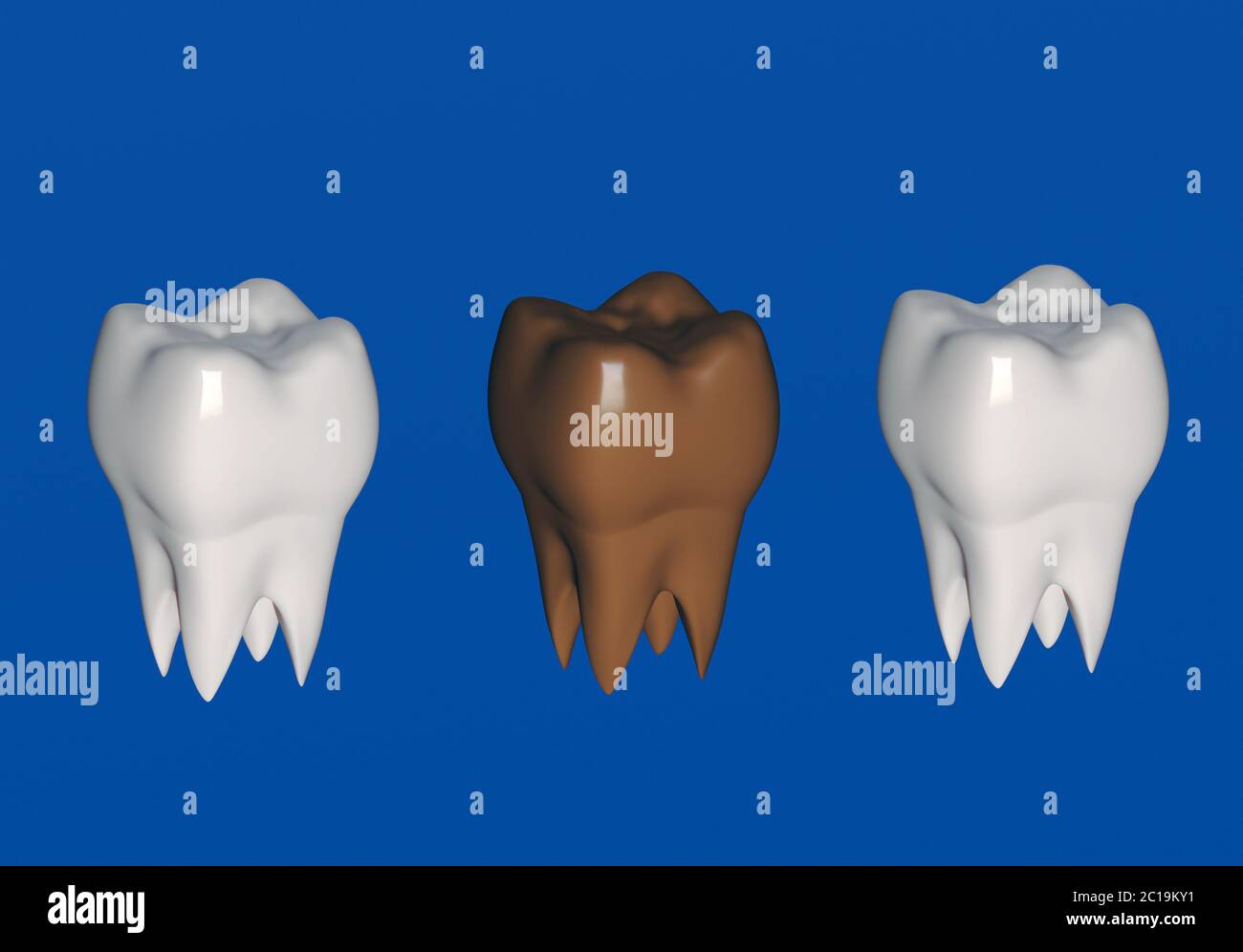 brown affected tooth, caries, dark tooth. 3d illustration Stock Photo ...