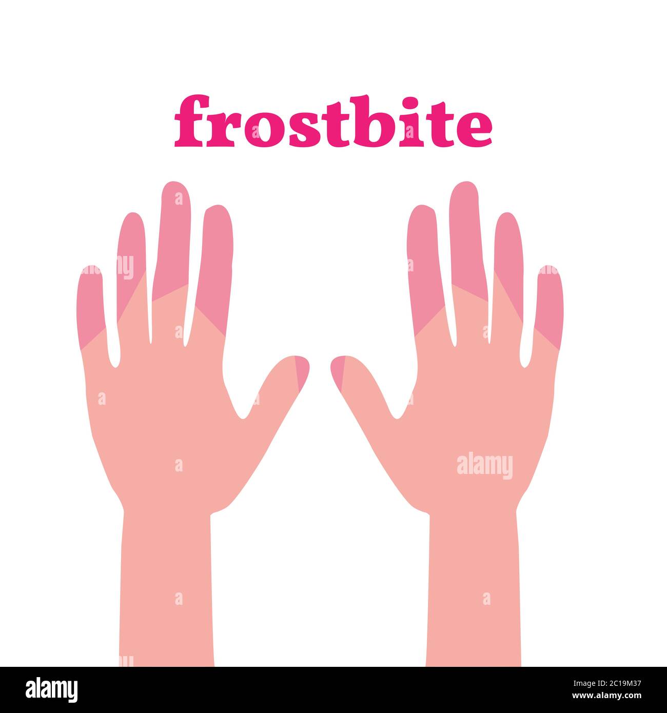 Got frostbite Stock Vector Images - Alamy