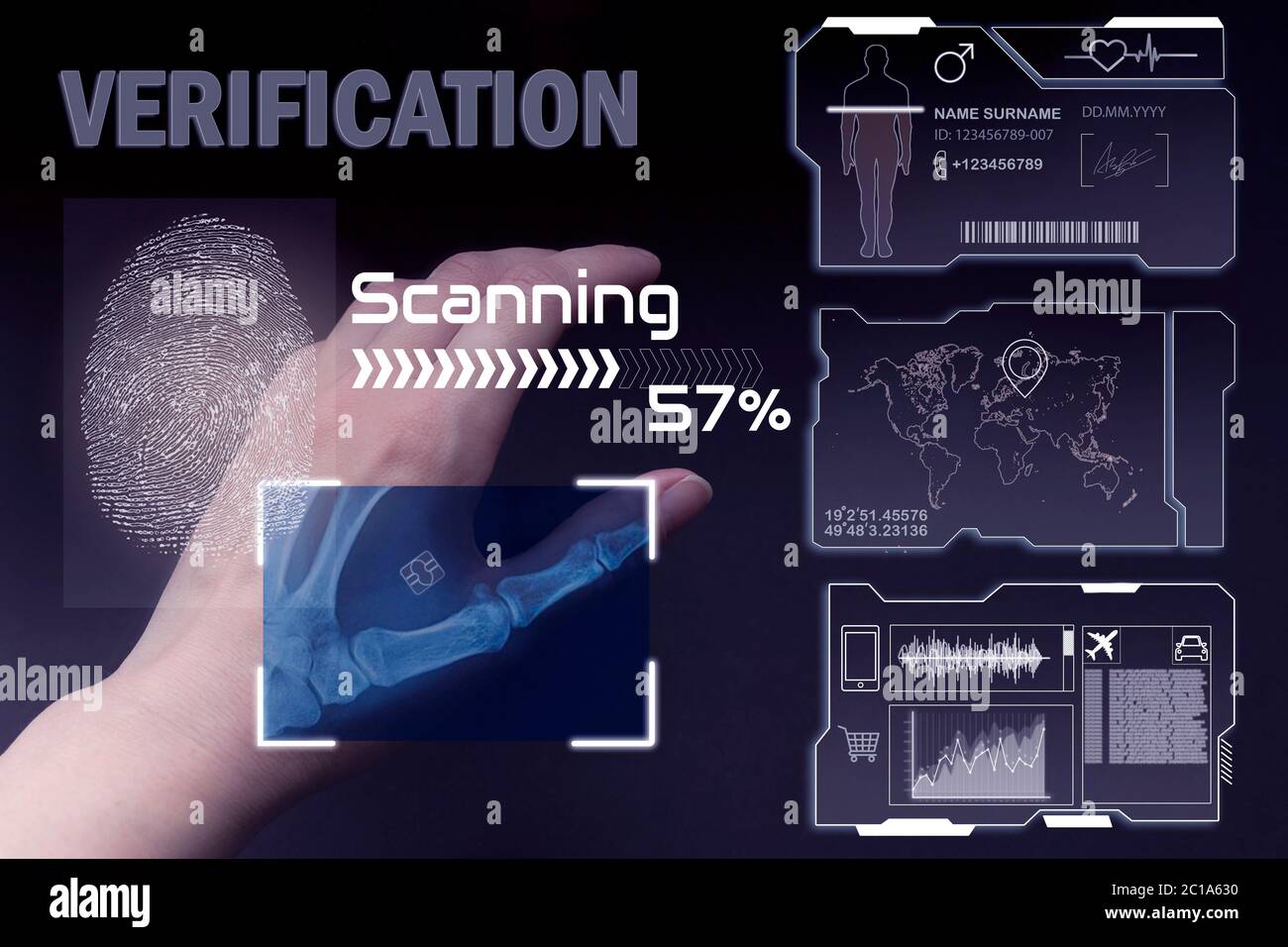 Cyber security network. arm with digital implants and microchips under ...