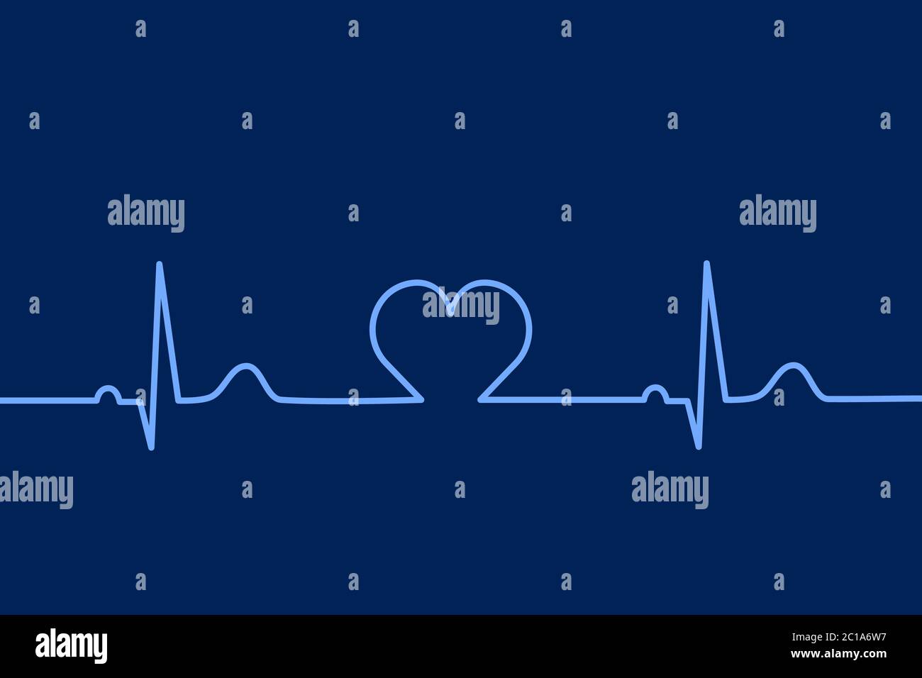 Normal Heart Rate Line