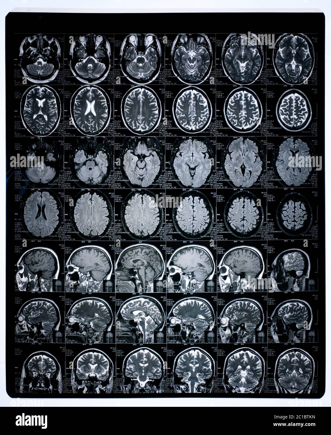Brain MRI of an adult male, toned Stock Photo - Alamy