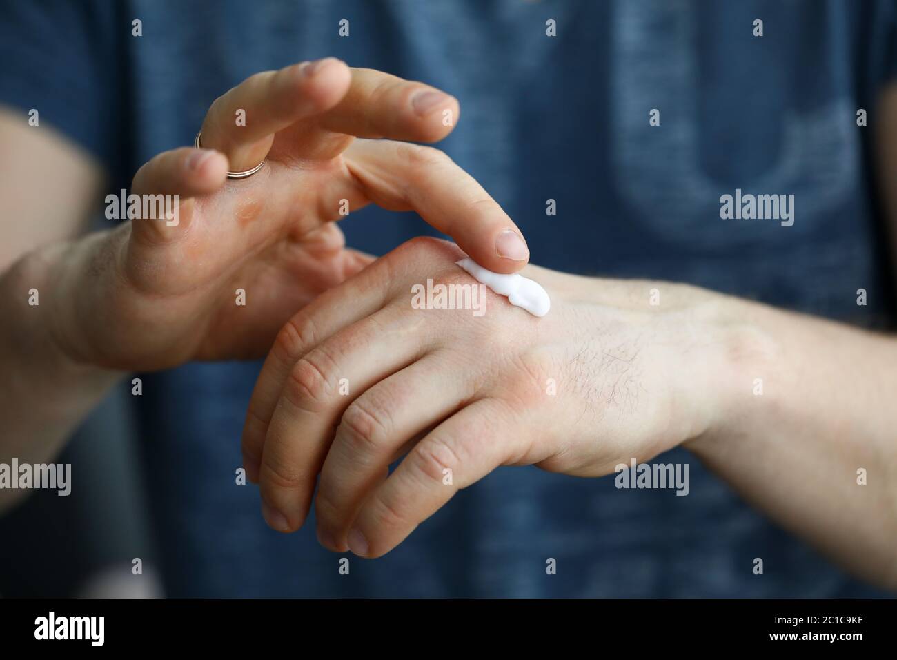 Close-up, man applying cream on skin his hand Stock Photo - Alamy