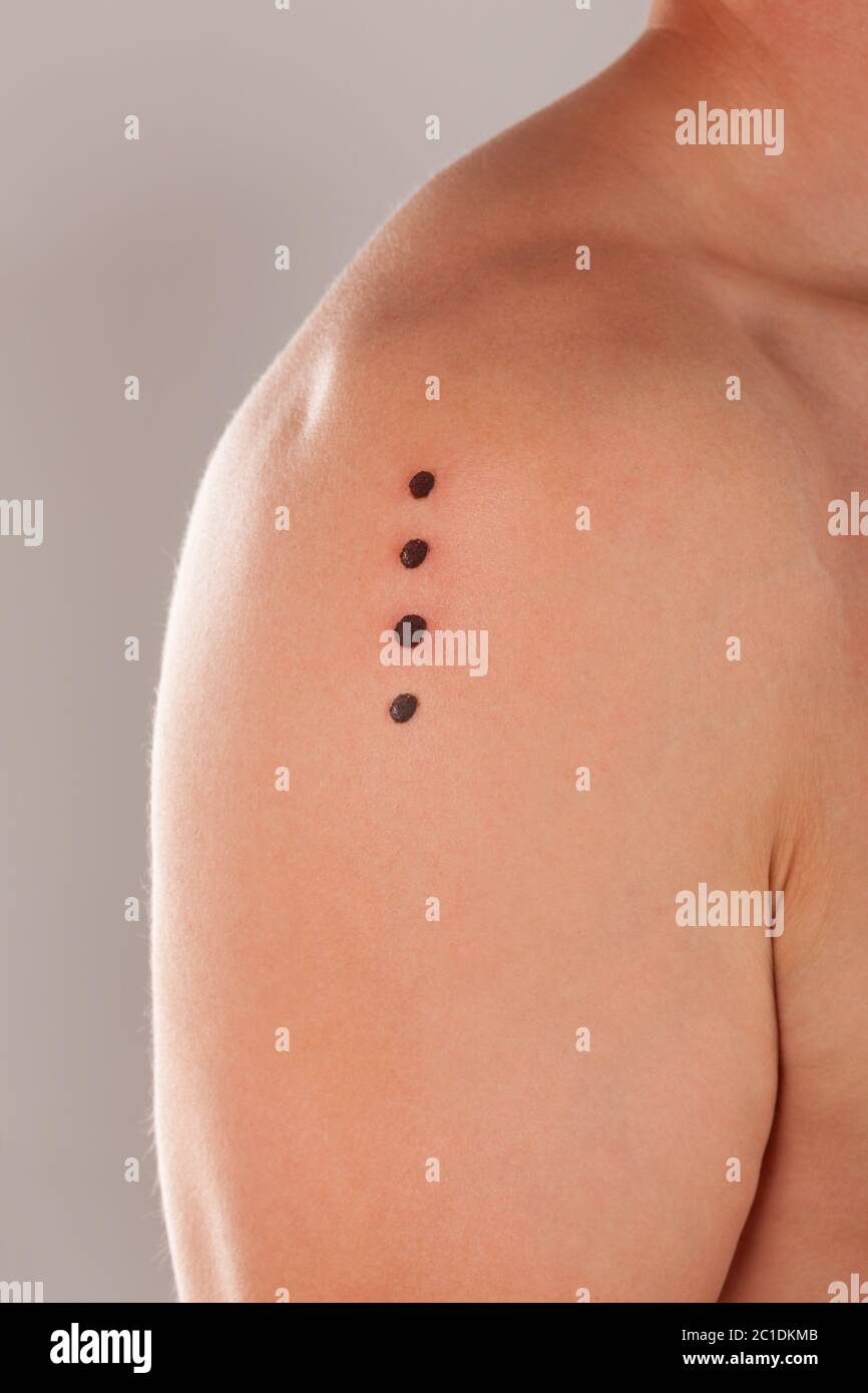 Kambo, frog medicine Stock Photo - Alamy