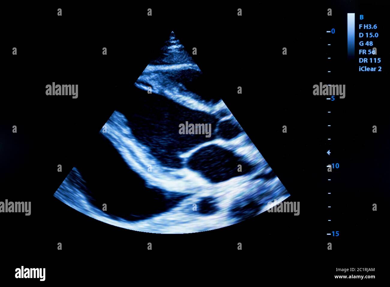 Colourful image of modern ultrasound monitor Stock Photo - Alamy